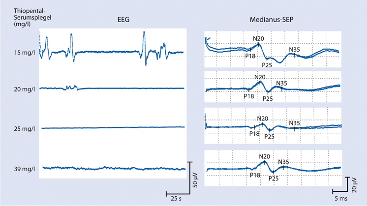 Differenzialdiagnostisch relevante Untersuchungsbefund bei ...