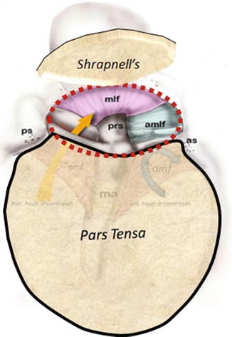 Middle Ear Compartments | SpringerLink