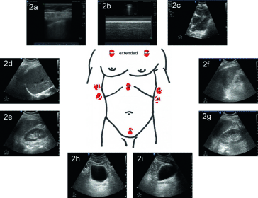 E-FAST | SpringerLink