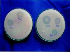 Functional Aspect of Phosphate-Solubilizing Bacteria: Importance in ...