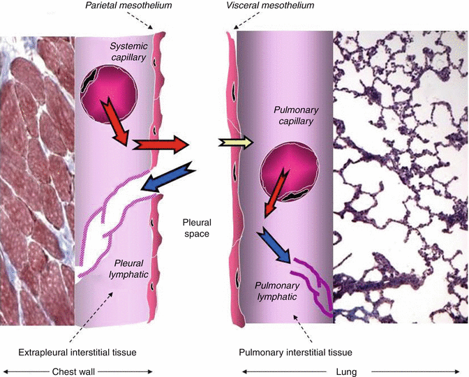 Physiology and Pathophysiology of the Pleural Space | SpringerLink