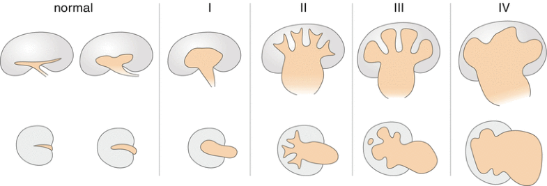 Sonographie der Niere, des Retroperitoneums und der Harnblase ...