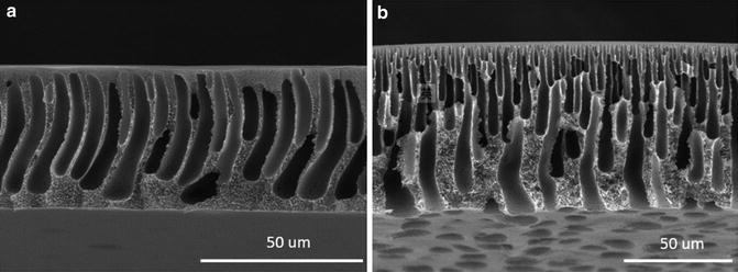 Finger-Like Structure | SpringerLink