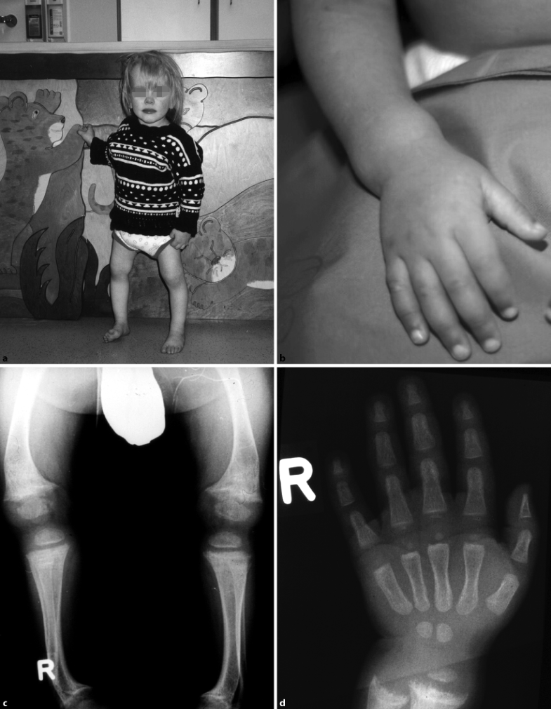 Störungen des Kalzium-Phosphat-Stoffwechsels | SpringerLink