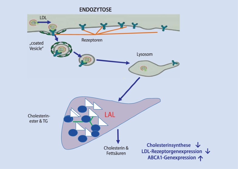 Cholesterinester speicherkrankheit (CESD) | SpringerLink