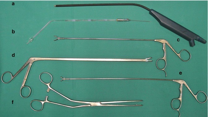 Mediastinoscopy | SpringerLink