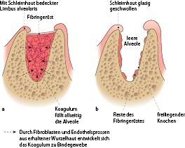 Chirurgische Eingriffe | SpringerLink