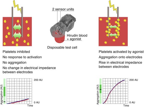 Point-of-Care Platelet Function Tests | SpringerLink