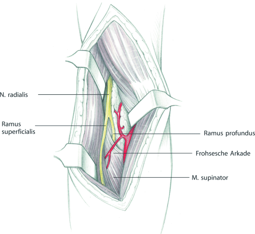 Kompressionssyndrome des N. radialis | SpringerLink