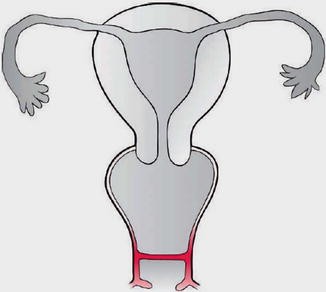 Hymen | SpringerLink