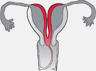 Hymen | SpringerLink