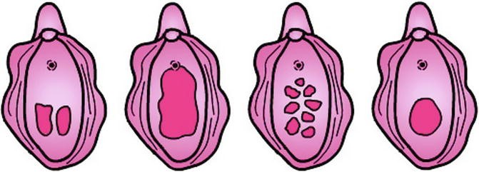 Hymen | SpringerLink