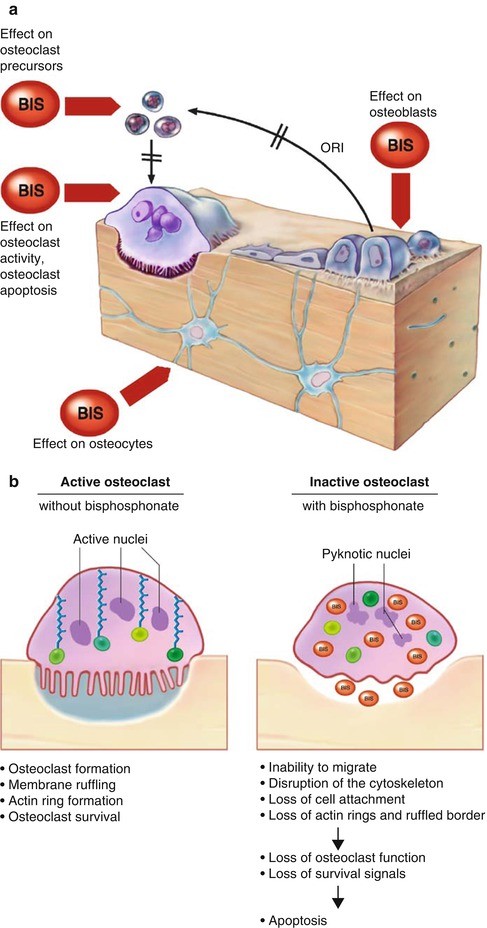 Pharmacological Aspects of Antiresorptive Drugs: Bisphosphonates and ...