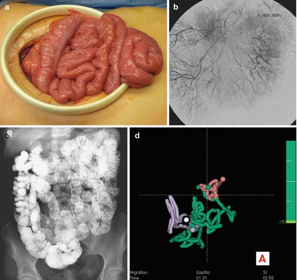 Normal Small Intestine | SpringerLink