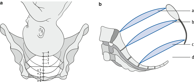 Normale Geburt | SpringerLink