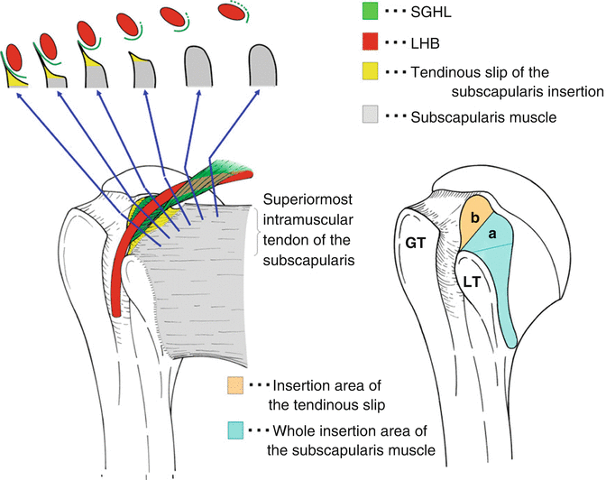 BicepsBiceps Tendon | SpringerLink