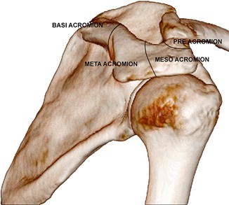 Acromion and Coracoacromial Arch | SpringerLink