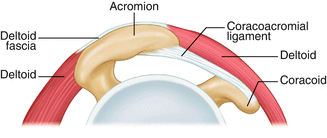 Acromion and Coracoacromial Arch | SpringerLink
