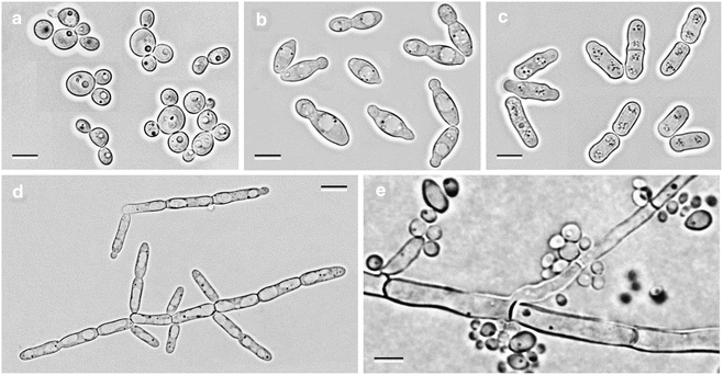 1 Saccharomycotina and Taphrinomycotina: The Yeasts and Yeastlike Fungi ...