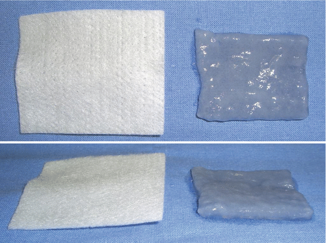 Interactive Wound Dressings | SpringerLink