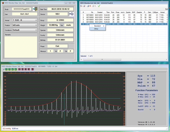 High Definition Oscillometry: Non-invasive Blood Pressure Measurement ...