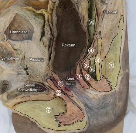 Analabszess und Analfistel | SpringerLink