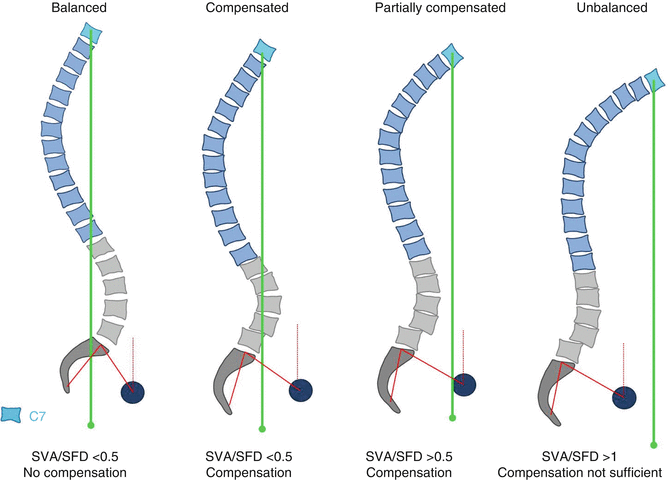 Compensatory Mechanisms Contributing to the Maintenance of Sagittal ...