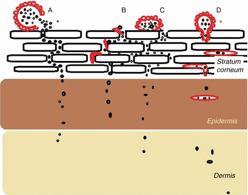 Liposomes as Drug Delivery Systems in Dermal and Transdermal Drug ...