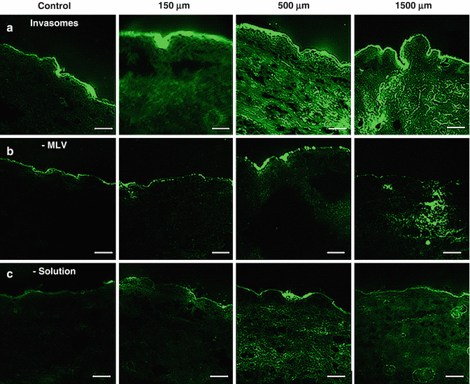 Invasomes: Vesicles for Enhanced Skin Delivery of Drugs | SpringerLink