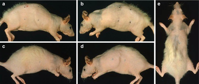Invasomes: Vesicles for Enhanced Skin Delivery of Drugs | SpringerLink