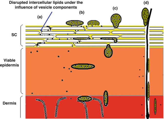 Ultradeformable Vesicles as Skin Drug Delivery Systems: Mechanisms of ...