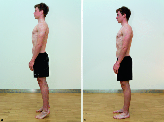 Wirbelsäule | SpringerLink