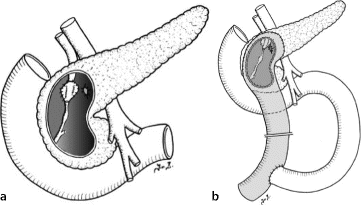 Pankreas | SpringerLink