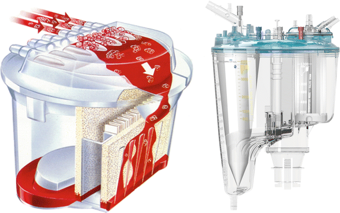 Herz-Lungen-Maschine | SpringerLink