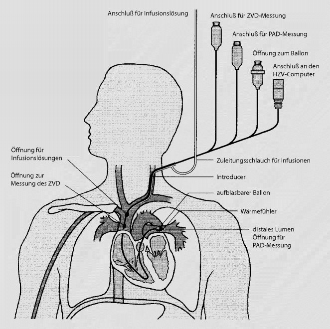 Invasive Maßnahmen | SpringerLink