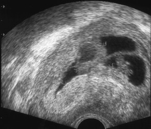 Fruchthöhle und Plazenta | SpringerLink