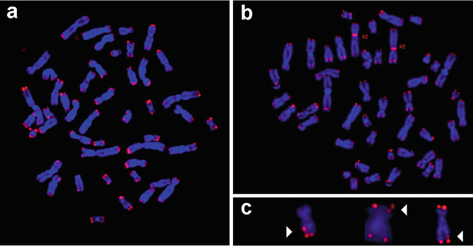 Telomere Length Measurement by FISH | SpringerLink
