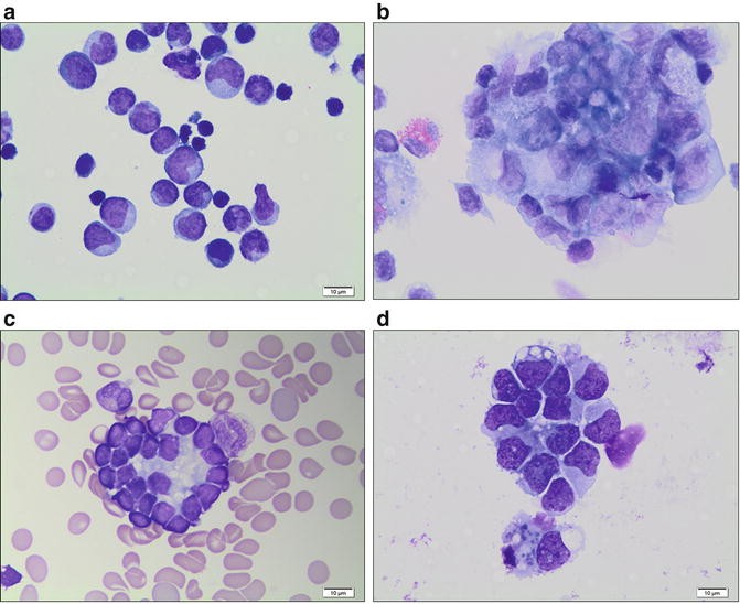 CSF and CNS Cytology | SpringerLink