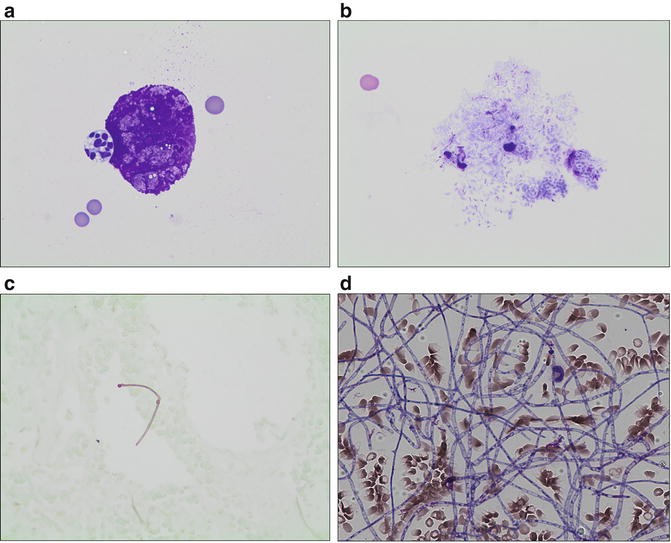 Artifacts, Contaminants, and Mimics in Cytology | SpringerLink