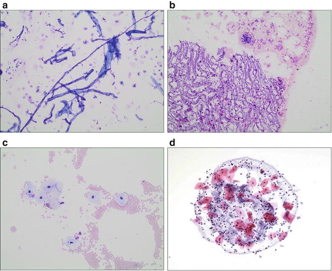 Artifacts, Contaminants, and Mimics in Cytology | SpringerLink