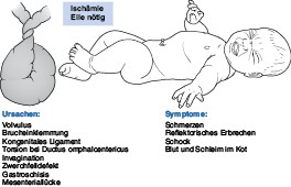 Magen-Darm-Erkrankungen | SpringerLink