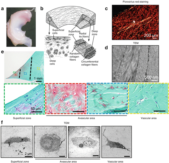 3D-Printed Artificial Meniscus | SpringerLink