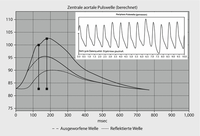 Die Analyse der Pulswellengeschwindigkeit | SpringerLink