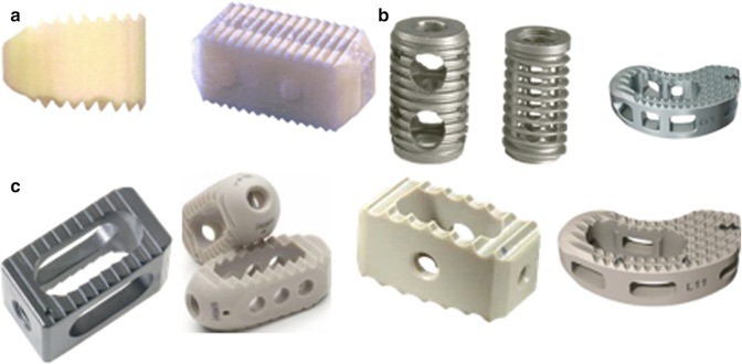 Interbody Cage Options | SpringerLink
