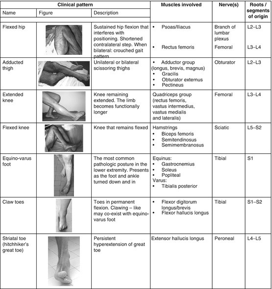Evaluation of Spasticity in Adults | SpringerLink