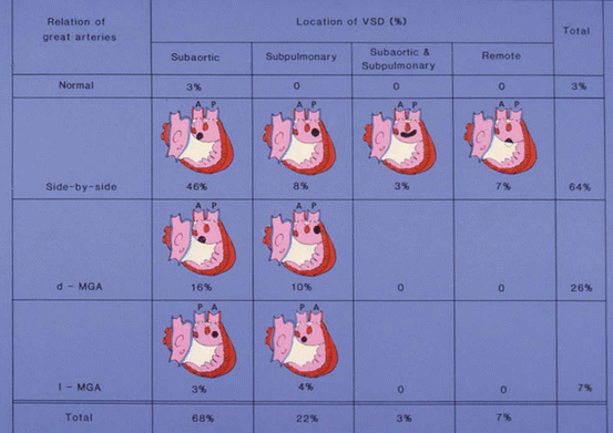 Clinical Presentation and Therapy of Tetralogy of Fallot and Double ...