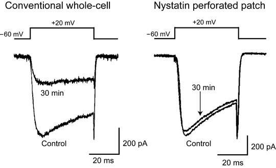 Perforated Whole-Cell Patch-Clamp Technique: A User’s Guide | SpringerLink