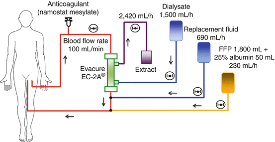 Plasma Diafiltration | SpringerLink