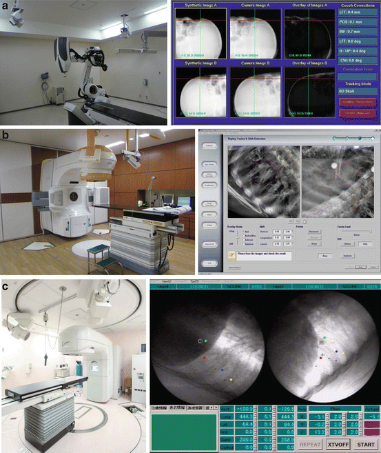 IGRT for IMRT | SpringerLink