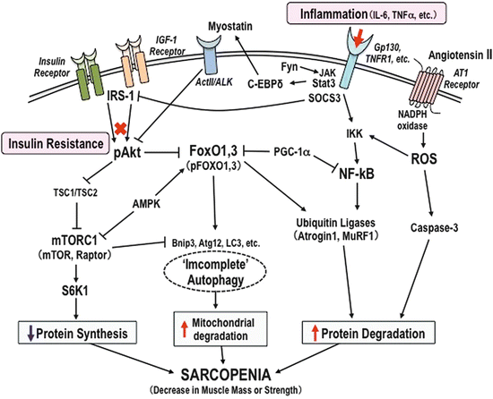 Sarcopenia in Diabetes Mellitus | SpringerLink